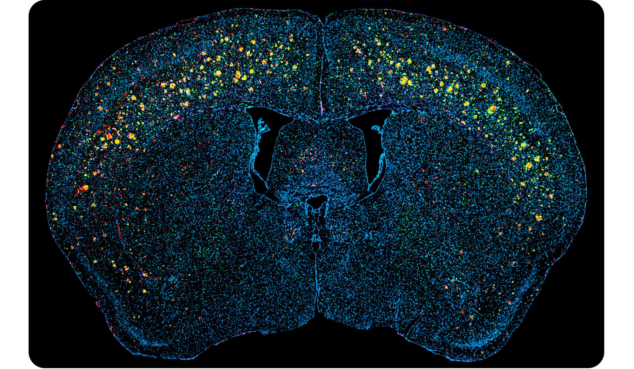 β-Amyloid Transgenic Models of Alzheimer’s Disease (APP/PS1 Models) | Biospective