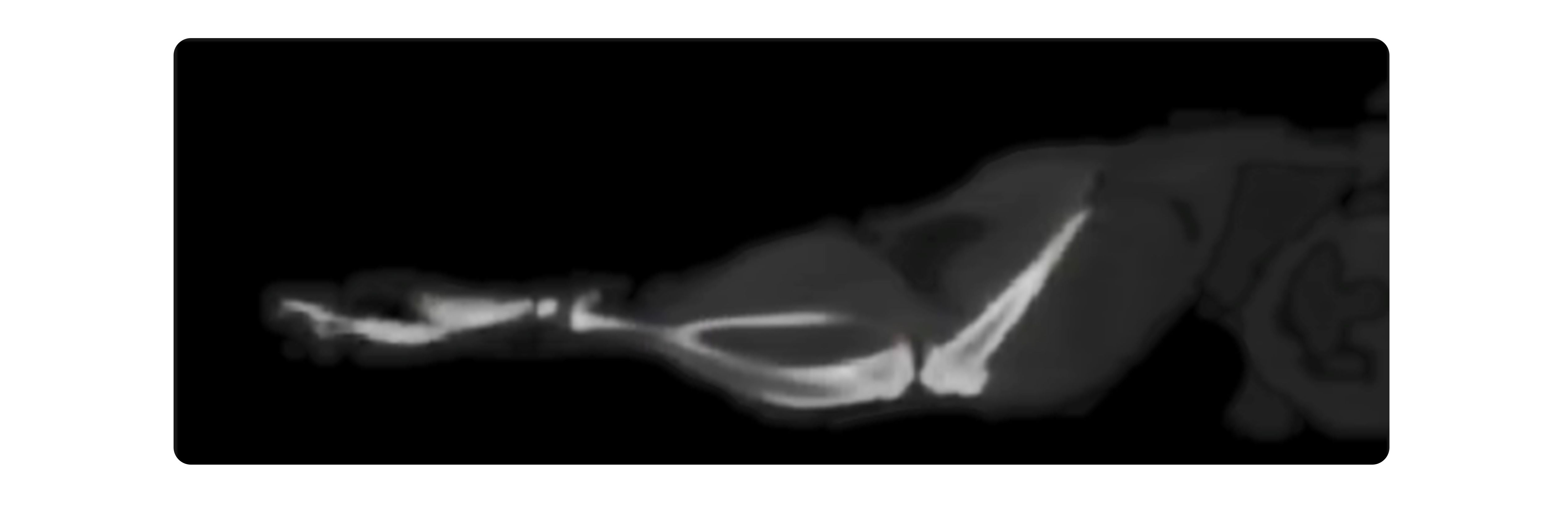 Computerized Tomography (CT) - In-vivo Imaging | Biospective