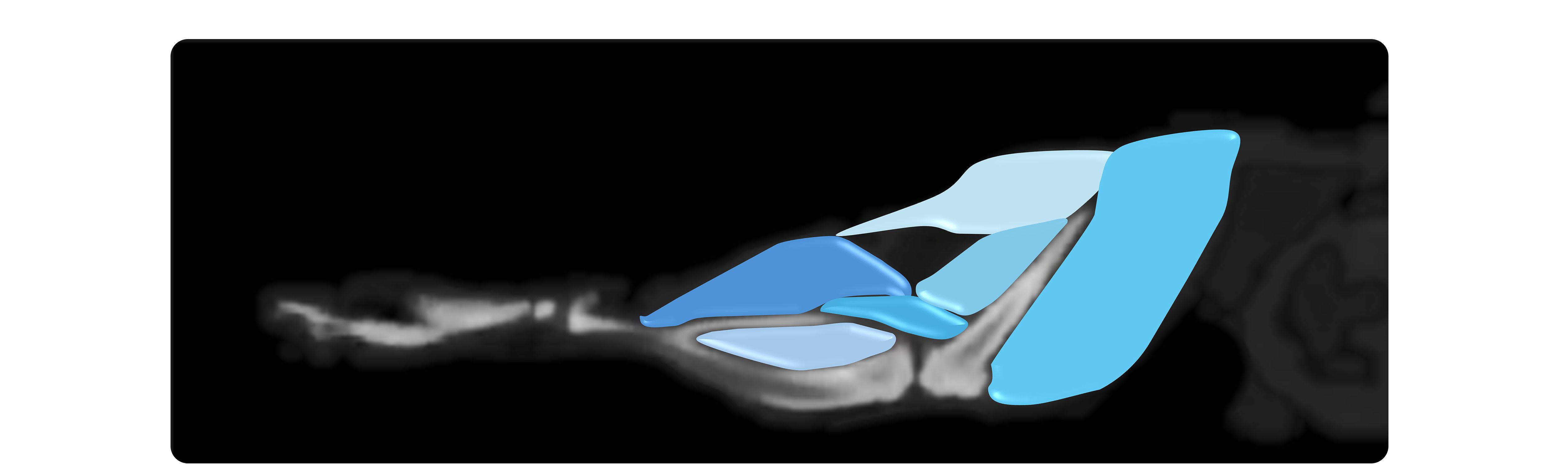 Computerized Tomography (CT) - In-vivo Imaging | Biospective