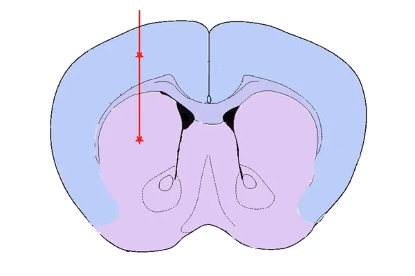 α-Synuclein Preformed Fibril (PFF) Parkinson's Models