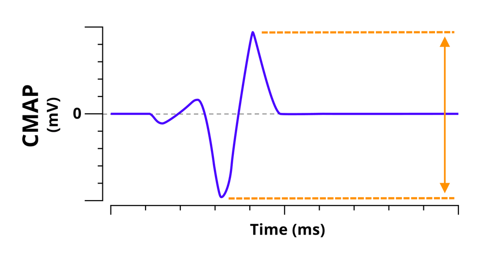 CMAP & MUNE (Motor) - Electrophysiology | Biospective