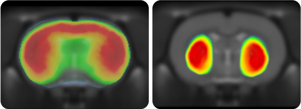 Positron Emission Tomography (PET) - In-vivo Imaging | Biospective