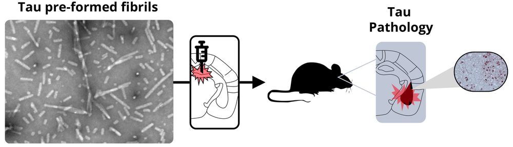 Tau fibril spreading Model of Alzheimer’s Disease | Biospective